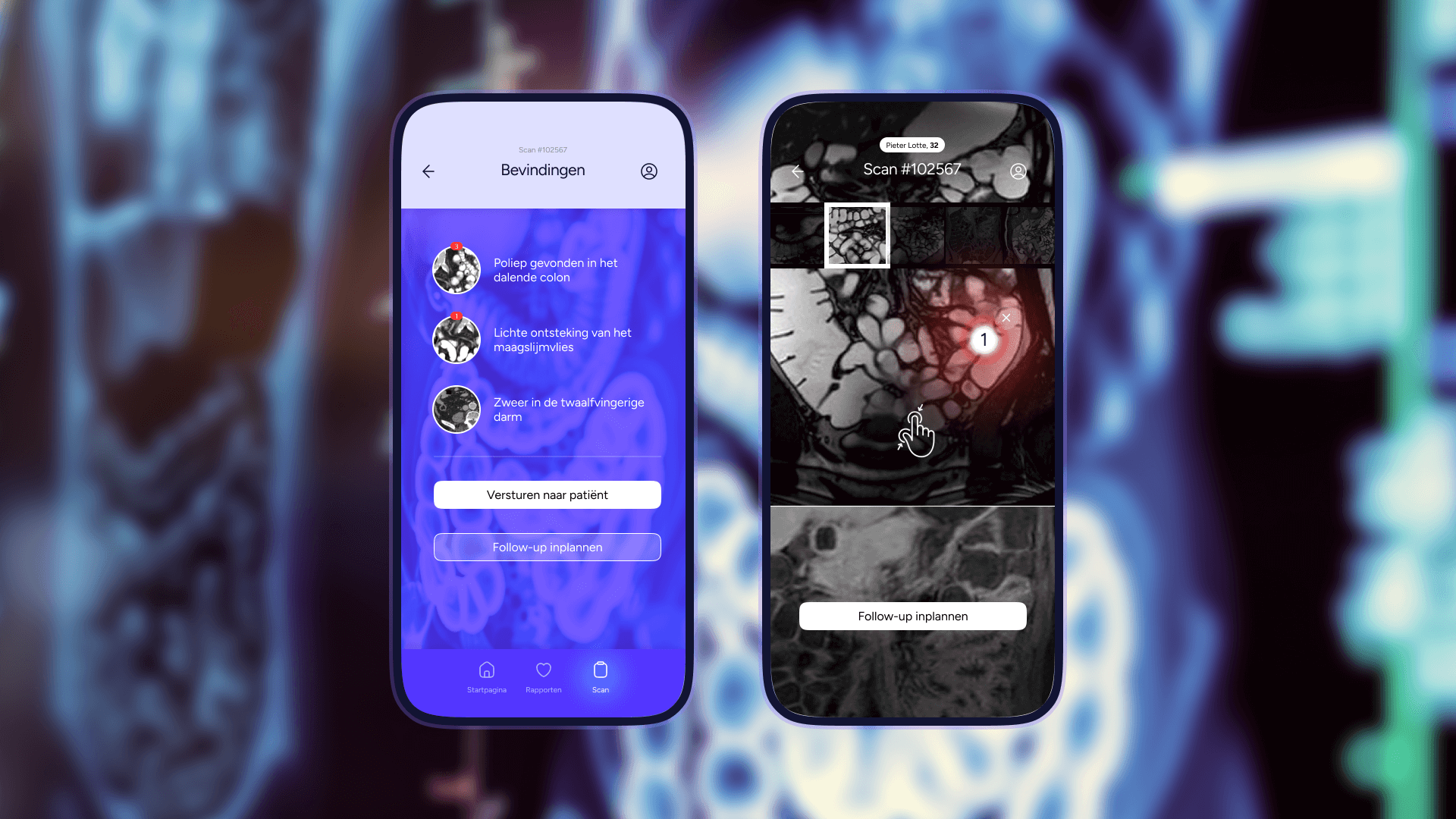 Medical App for Doctors: NL Colosurv RL for Patient Assessment [Case ...